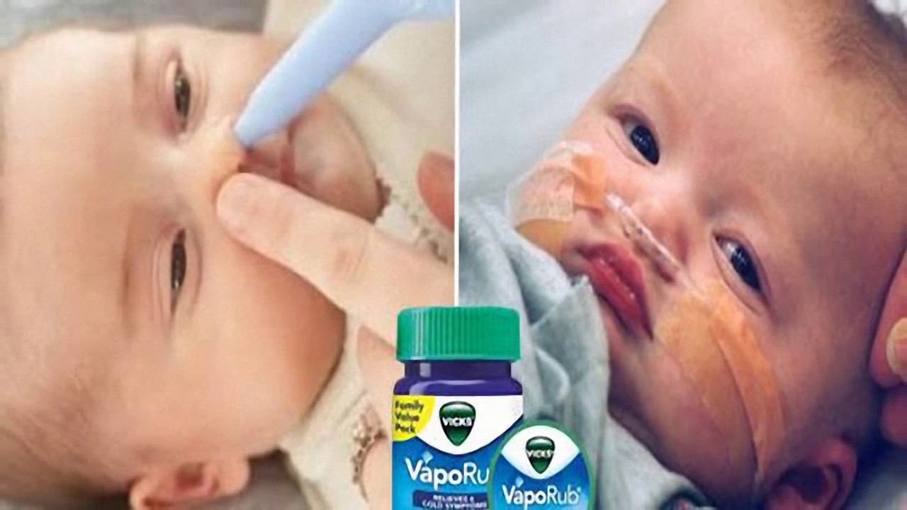 Una madre le untó Vick VapoRub a su bebé y horas después partió al ...